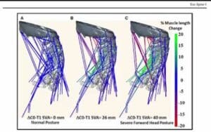 Cervical Sagittal Balance and Clinical Practice – Professionally ...