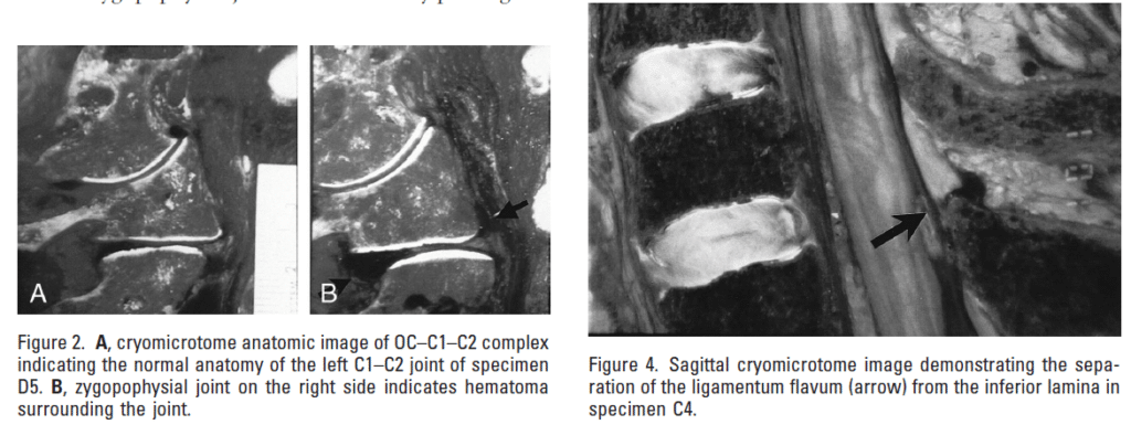 WAD, Xray, CT, and what is missed. – Professionally Integrated Care