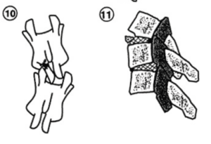 Effects of cervical spine posture on axial load bearing ability: a ...