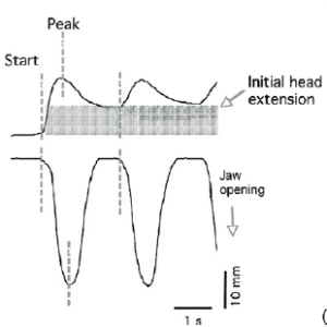 Cervico-Craniomandibular Disorder (CCMD) from MVC – Professionally ...