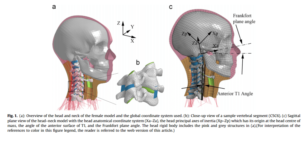 A female head–neck model for rear impact simulations – Professionally ...