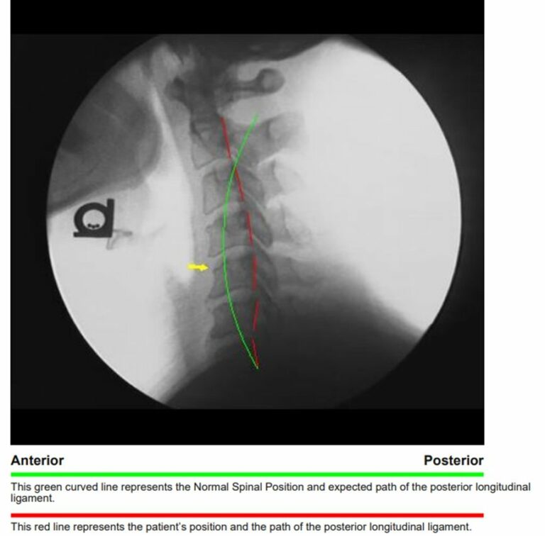 WEBINAR: Imaging Part 1 of 2 – Static X-Rays and MRIs – Professionally ...