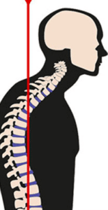 Forward Head Posture and How it Affects Balance, Increases Falls, etc ...