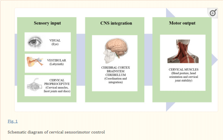 Proprioception, Neck pain, Discs, Joints, posture and balance ...